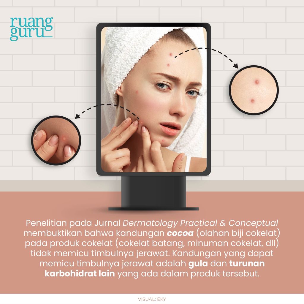 Benarkah Makan Cokelat Bisa Bikin Jerawatan dan Keracunan?